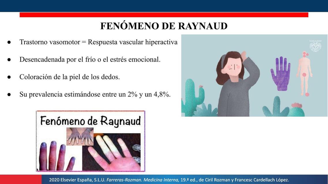 Fenómeno de raynaud | Joselyn Pauleth | uDocz