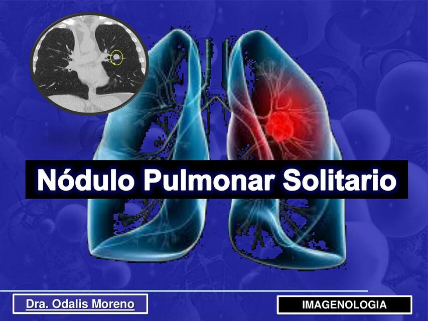 📸 NODULO PULMONAR SOLICITARIO 🫁 - IMAGENOLOGÍA 🩻 | Dra Odalis Moreno ...