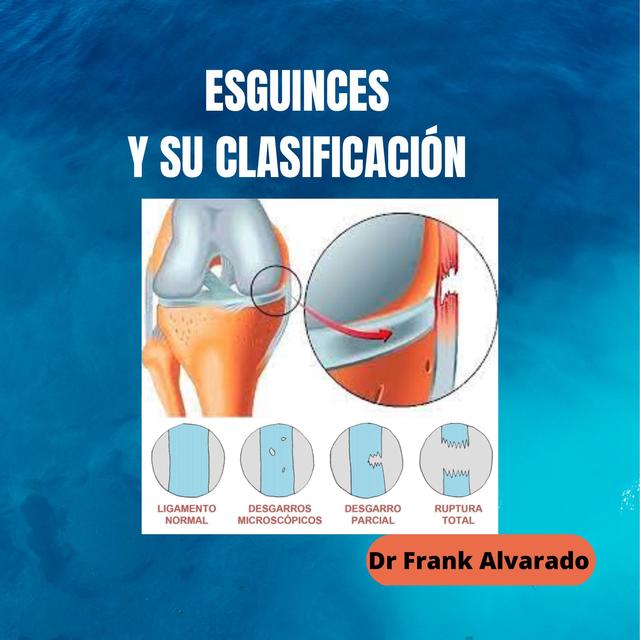 Esguinces y su clasificación | Moisés Francisco Alvarado García | uDocz