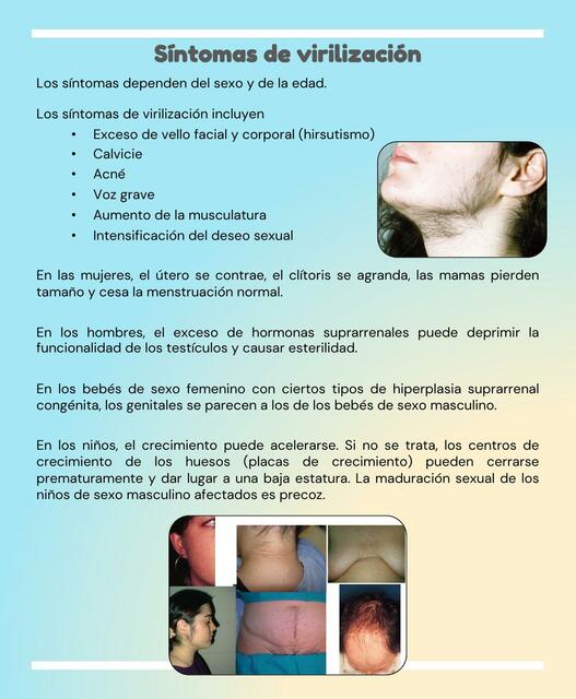 Síntomas de Virilización | Javier Rios | uDocz