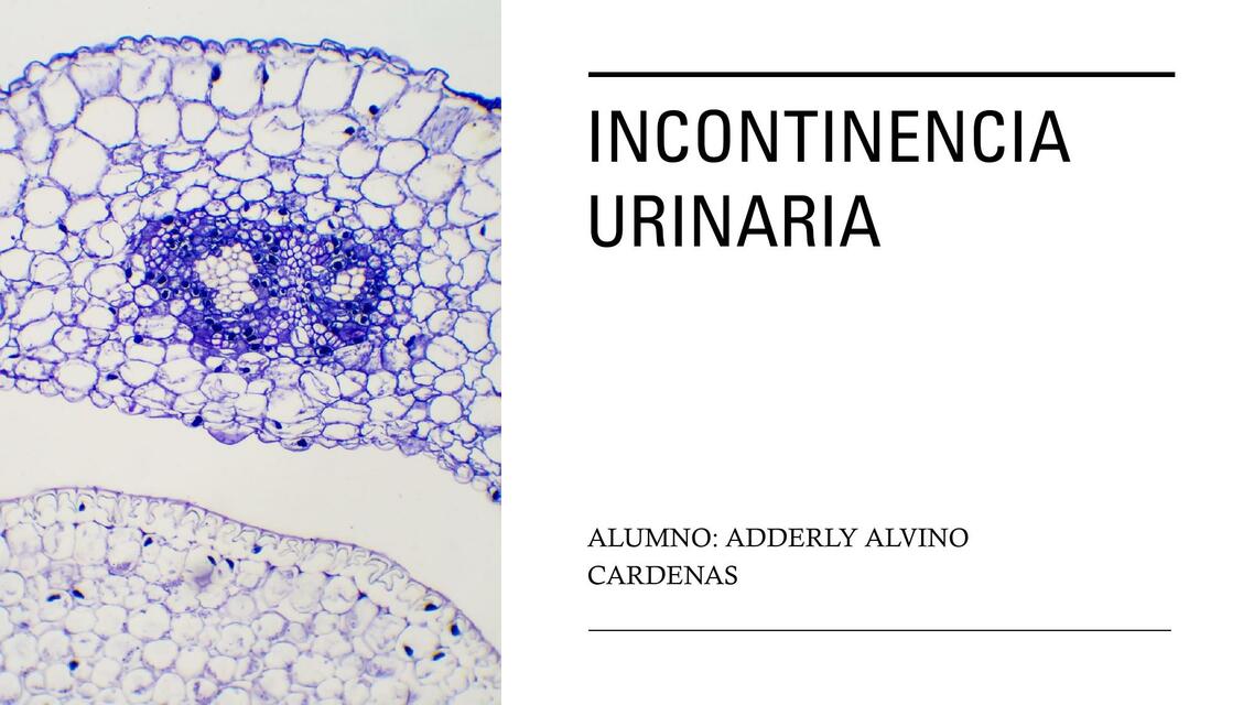 Incotinencia urinaria | Adderly Alvino | uDocz