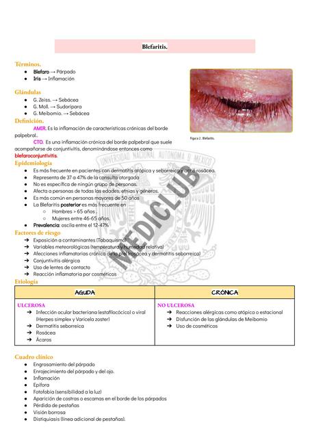 Blefaritis | Nadia Millan | uDocz