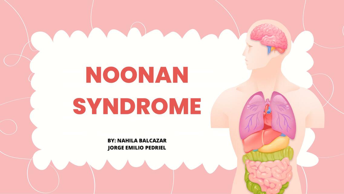Flashcards de NOONAN SYNDROME | Por Nahila Fernanda Balcázar ...