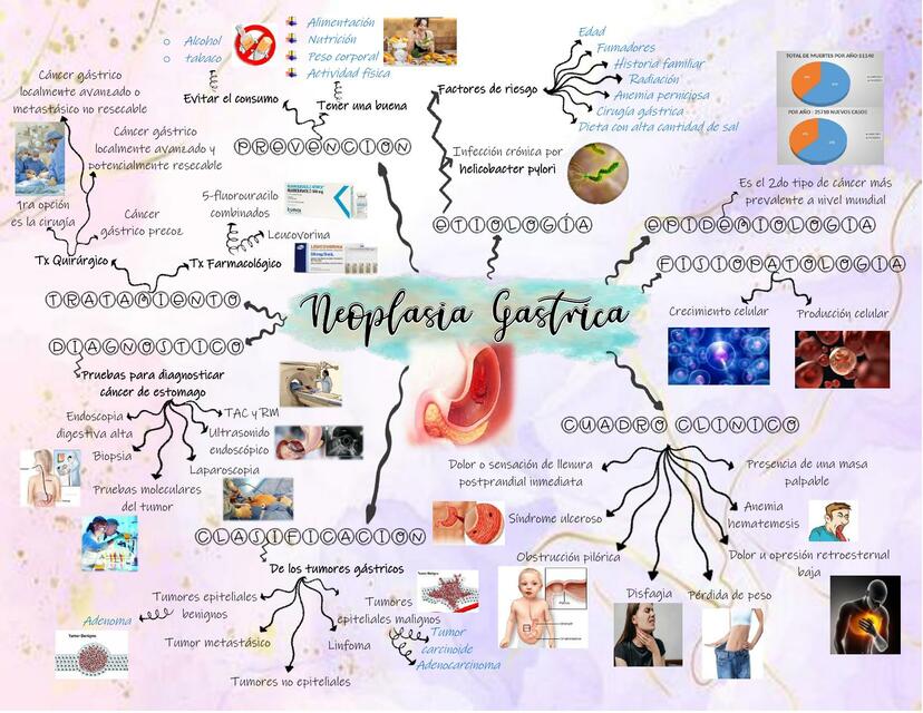 Neoplasia gastrica | Ela Choque | uDocz