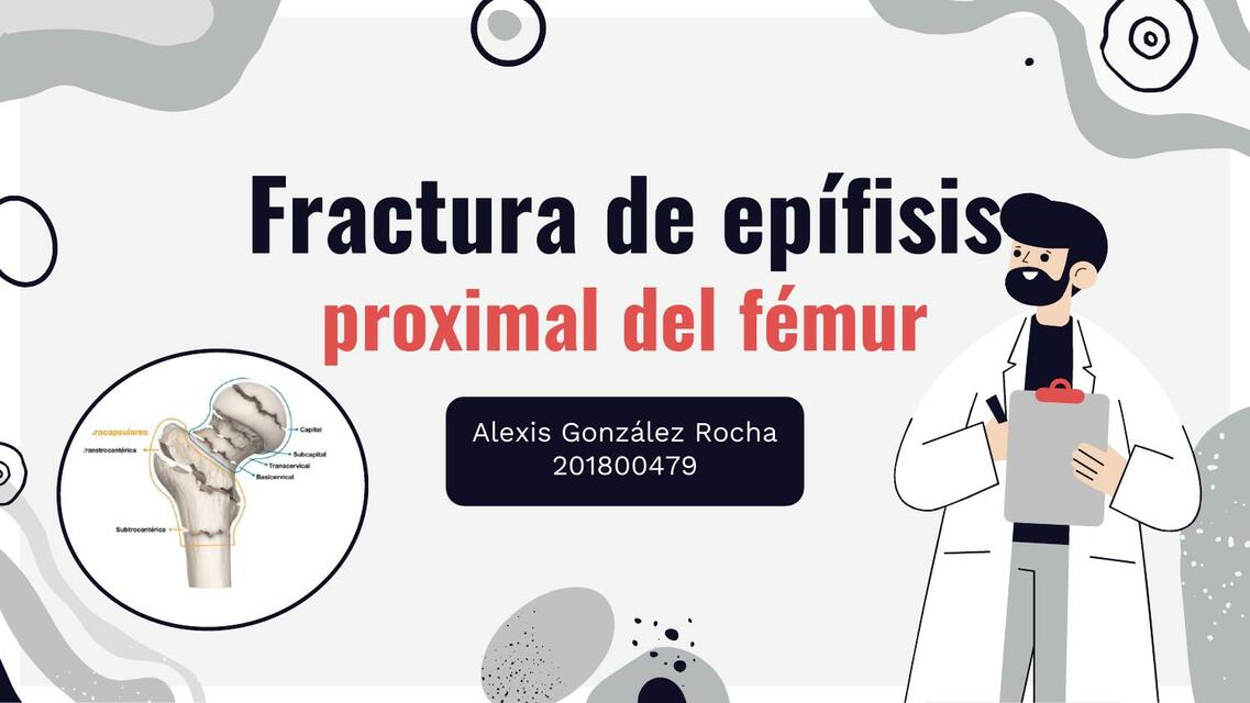 Fracturas de epifisis proximal de femur P | Alexis González | uDocz
