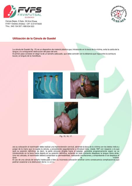 Utilización de la Cánula de Guedel | PAOLA | uDocz
