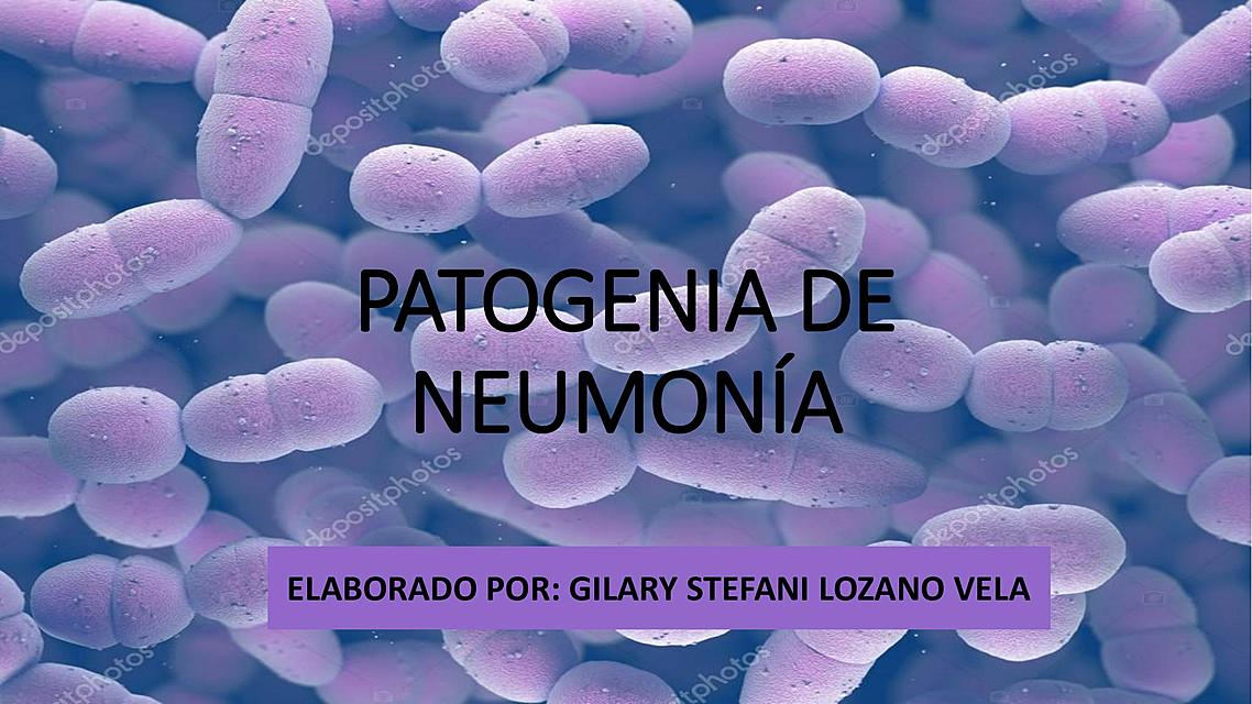 PATOGENIA DE NEUMONÍA | uDocz