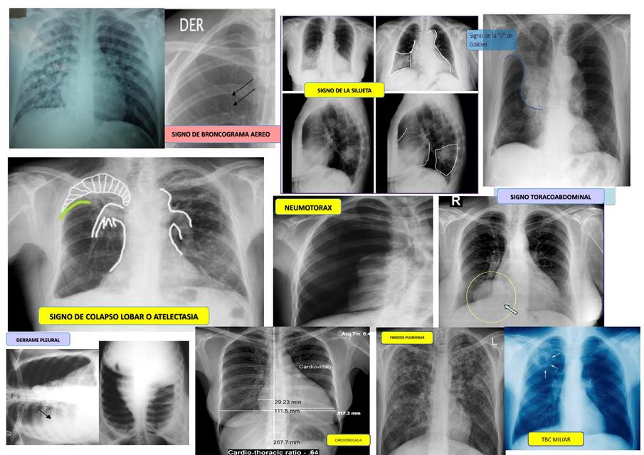 Tórax del aparato digestivo urinario | LESLIE ELIZABETH RAFAEL CHARAJA ...
