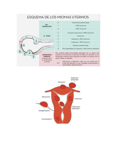 Esquema de los Miomas Uterinos | Guadalupe Hernández Aquije | uDocz