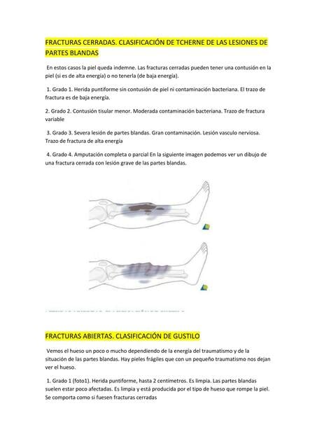 Grados fracturas | Carla Strohalm | uDocz