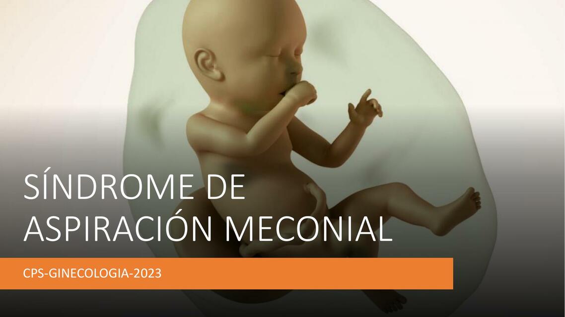 Síndrome de Aspiración Meconial | Anelisse Daza | uDocz
