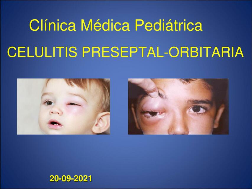 Celulitis preseptal orbitaria | Vasco | uDocz