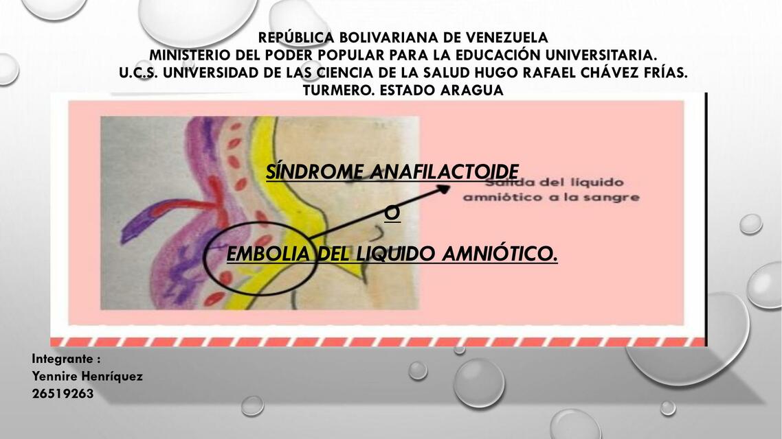 Síndrome Anafilactoide o Embolia del Líquido Amniótico | yennire ...