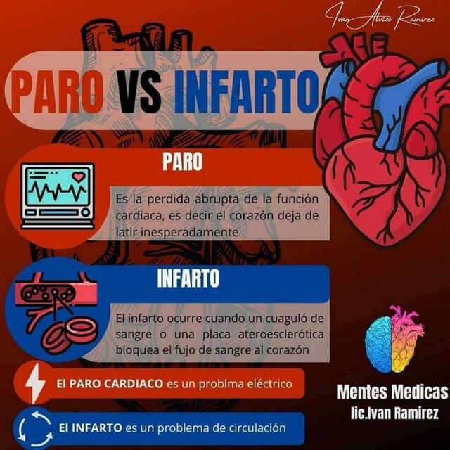 Paro vs Infarto | YUDOC.ORG | uDocz