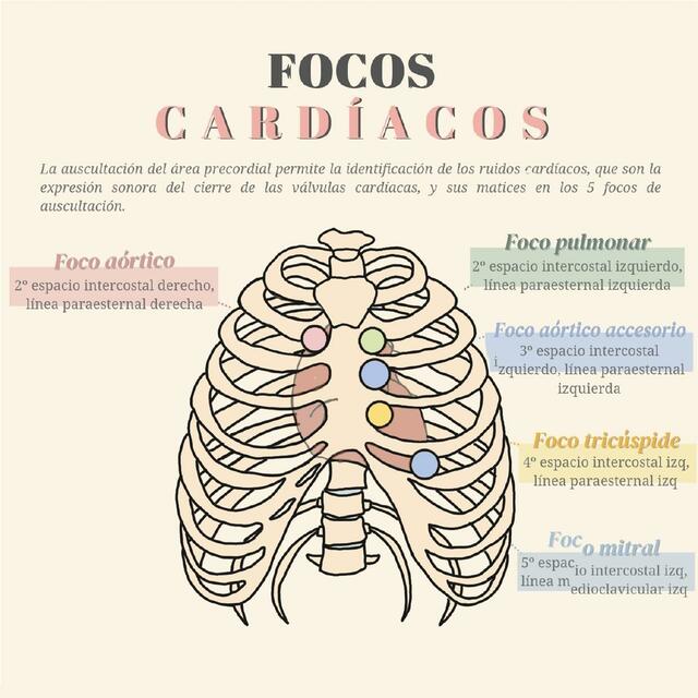 Focos Cardiacos | VODX | uDocz