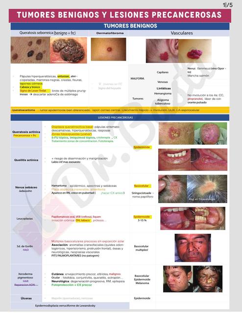 Resumen CANCER DE PIEL | Dr. Basti | uDocz
