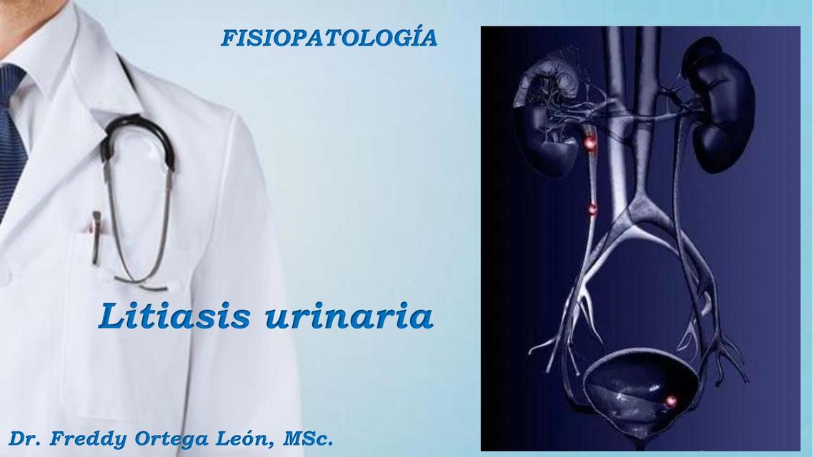 Litiasis urinaria | maria garcia | uDocz