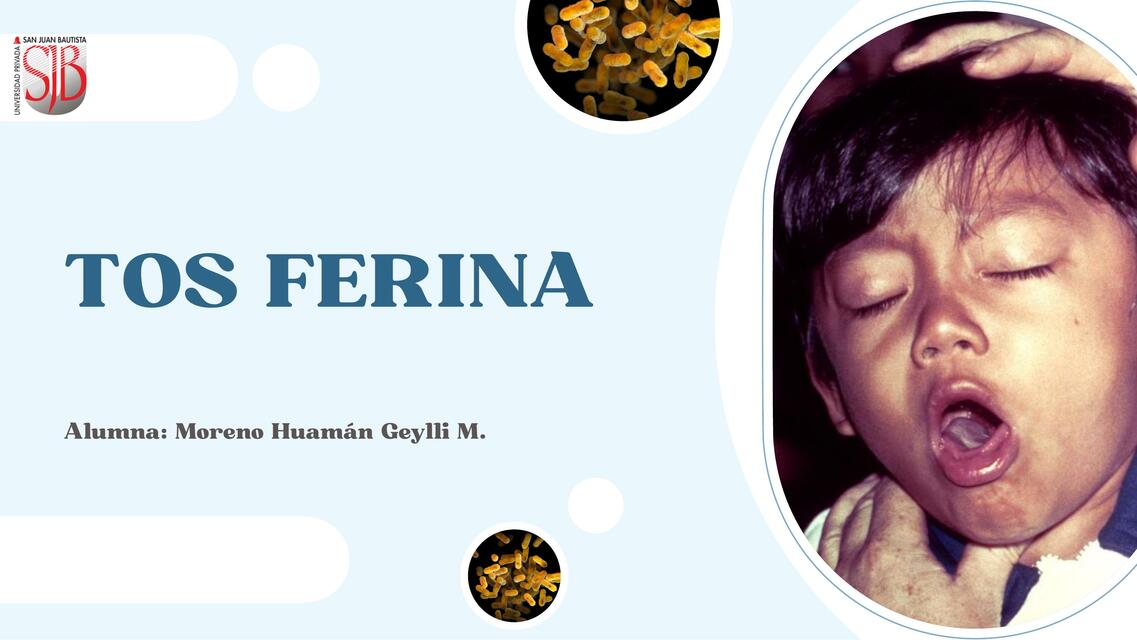 Tos Ferina | Apuntes de Medicina! | uDocz