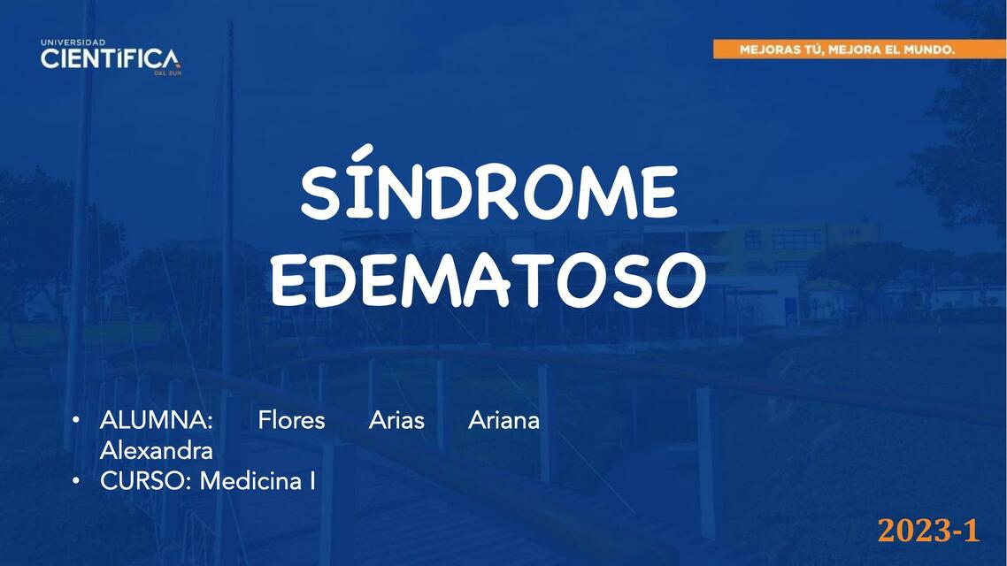Síndrome edematoso | Fiorella Vargas Camasca | uDocz