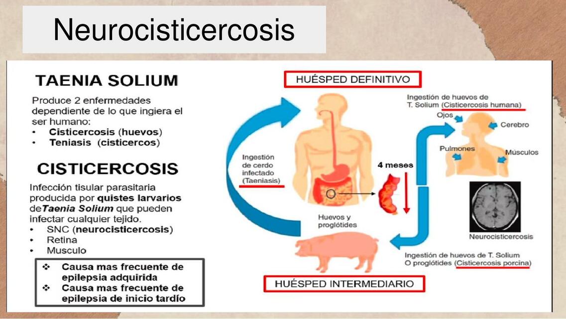 Neurocisticercosis | Dr. Memorize | uDocz