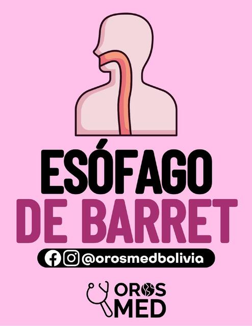 Esófago de Barret | uDocz | uDocz