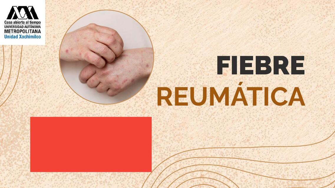 Fiebre reumática | G | uDocz