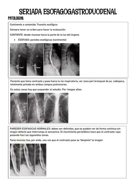 Seriada esófagogastroduodenal | Medicina en la UNER | uDocz