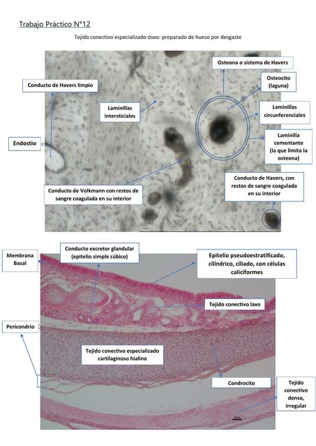 Tejido cartilaginoso y óseo | Julieta | uDocz