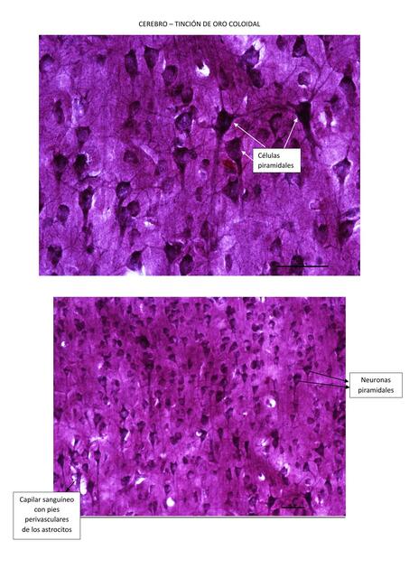 Histología Cerebro | Julieta | uDocz