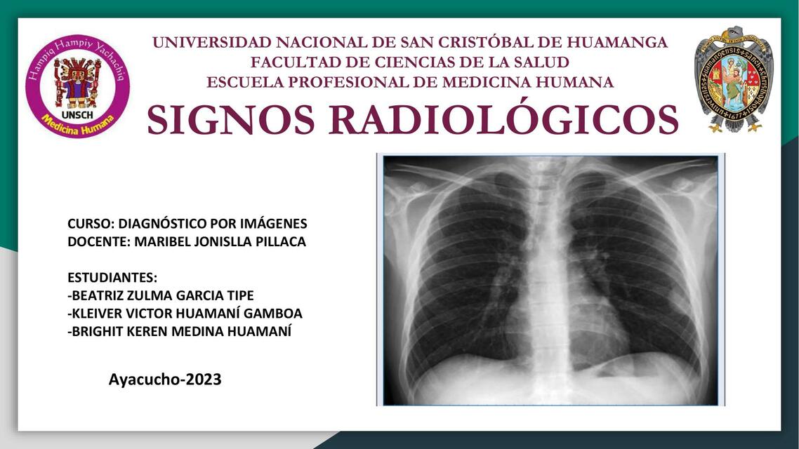 Radiología De Tórax | Jose Luis Bellido | uDocz