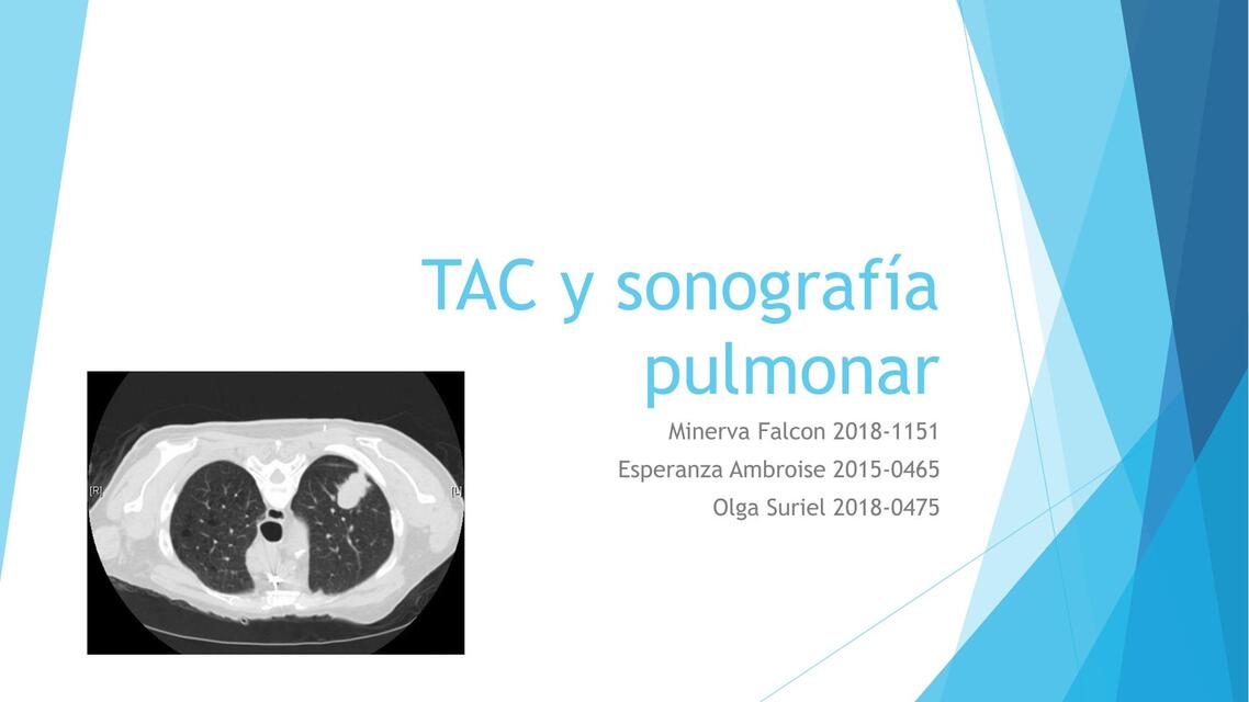 TAC y sonografía pulmonar | Minerva Falcon | uDocz
