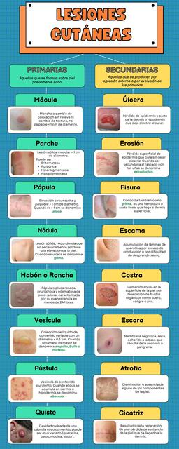 Lesiones Cutáneas | RUTH | uDocz