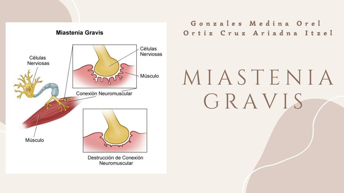 Miastenia Gravis | Ariadna Itzel Ortiz Cruz | uDocz