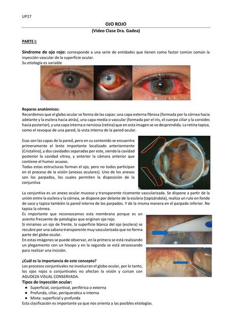 Ojo rojo- diferentes causas | Medicina en la UNER | uDocz