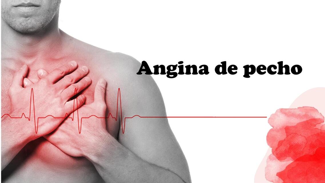 Angina de pecho | katherigne urueta | uDocz