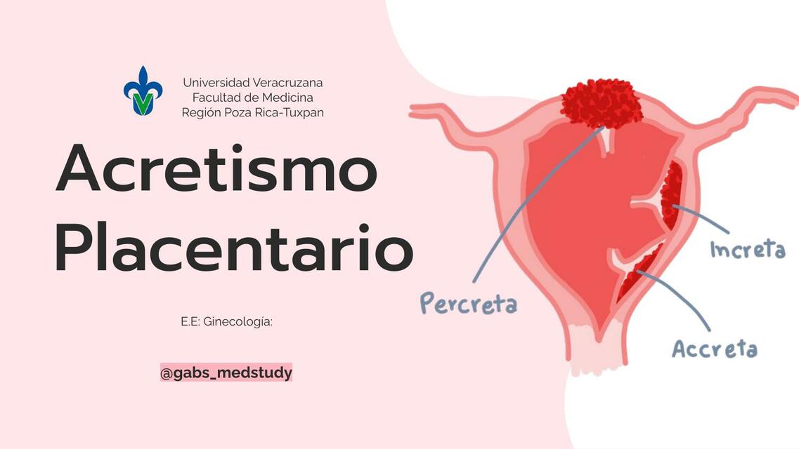Acretismo Placentario GyO | gabs_medstudy | uDocz