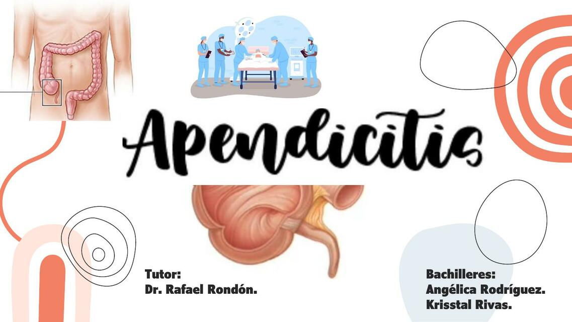 Apendicitis | Francia Silva | uDocz