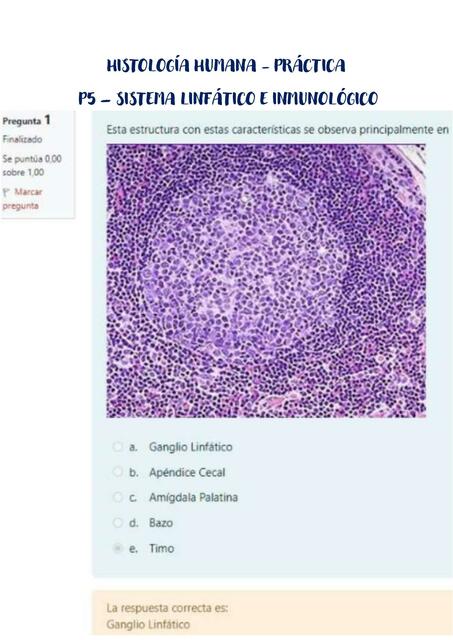 Histología P5 Sistema Linfático e Inmunológico | Briggitte Yamilé Suarez Esteban | uDocz