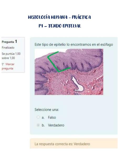 Histología P1 Tejido Epitelial | Briggitte Yamilé Suarez Esteban | uDocz