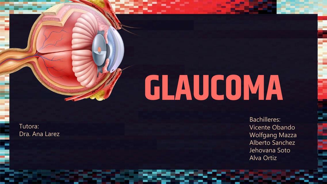 Glaucoma | Eilin Lanza | uDocz