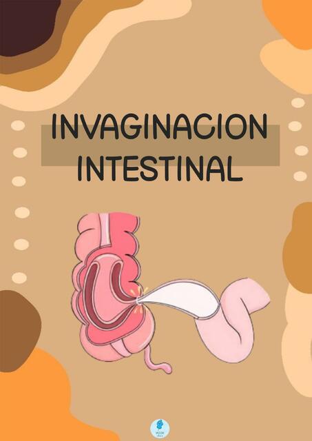 Invaginacion Intestinal | VODX | uDocz