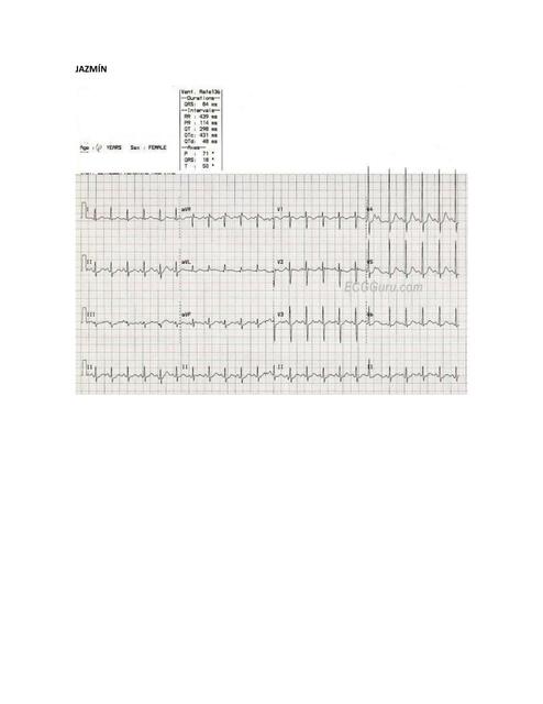 Cardiología | pamela gamez | uDocz