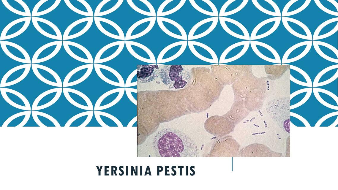 Yersinia pestis | CIENCIAS DE LA SALUD | uDocz
