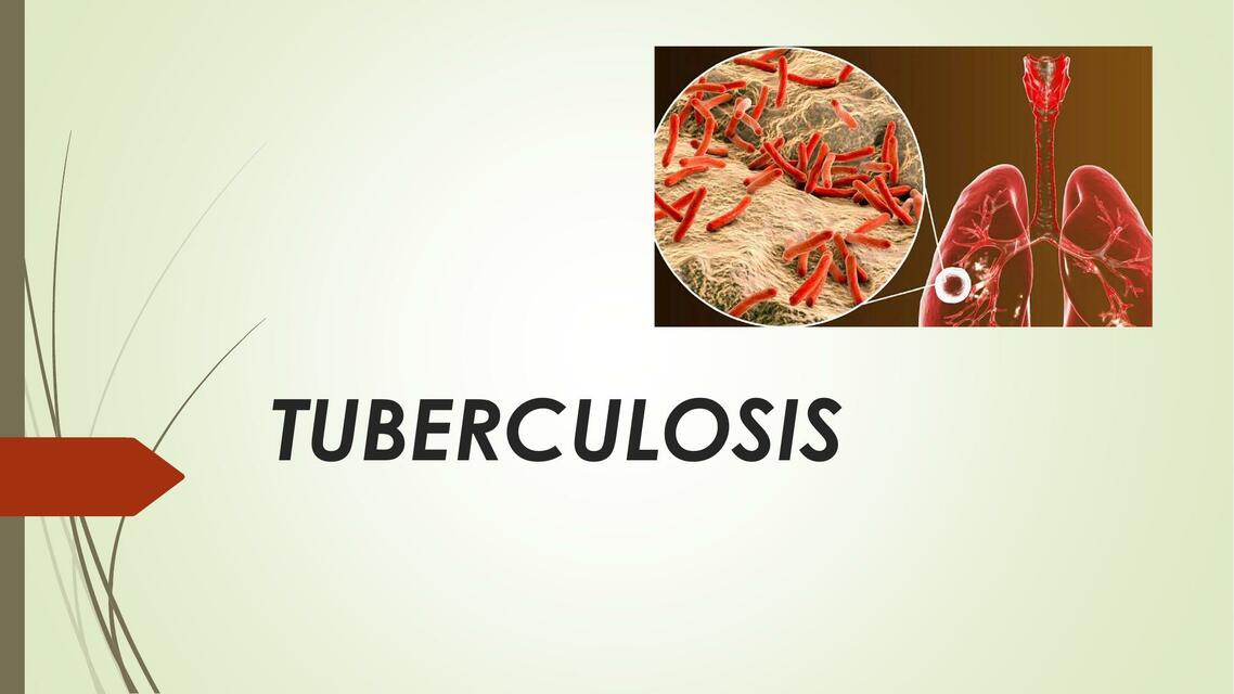 Diagnostico y tratemiento de la tuberculosis | CIENCIAS DE LA SALUD | uDocz