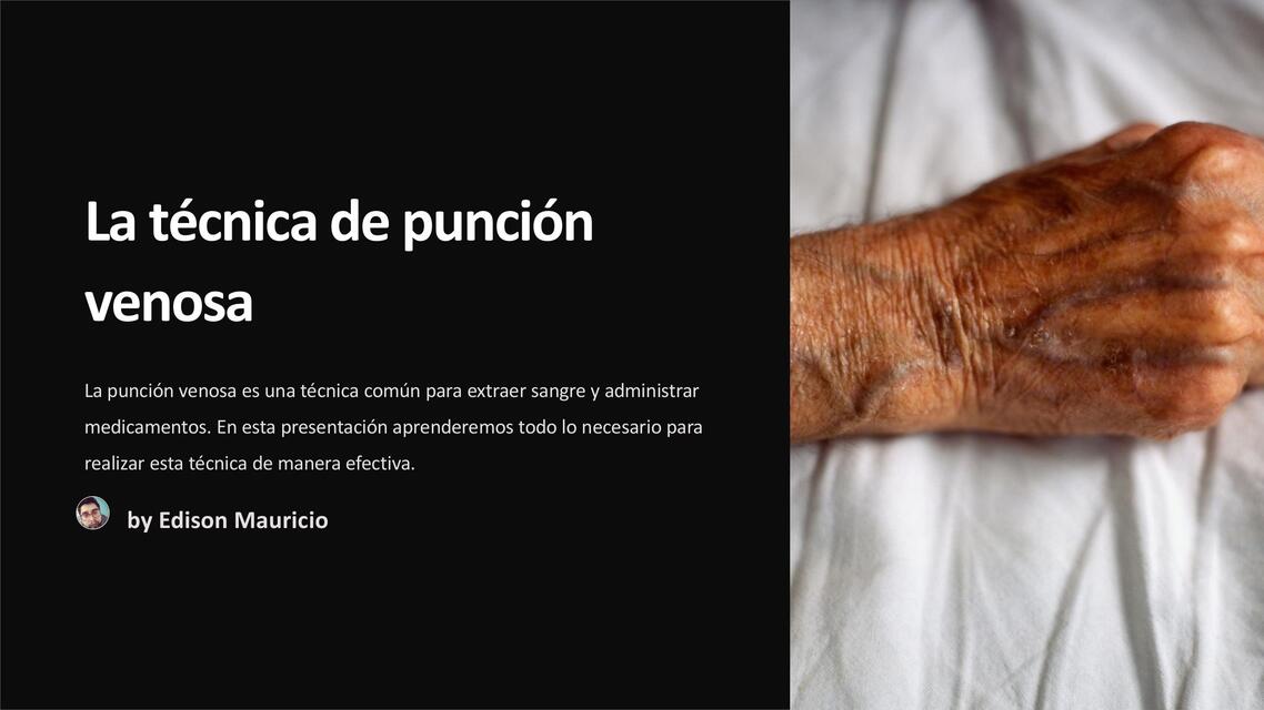 La tecnica de puncion venosa | ANTONIA CORDOVA | uDocz