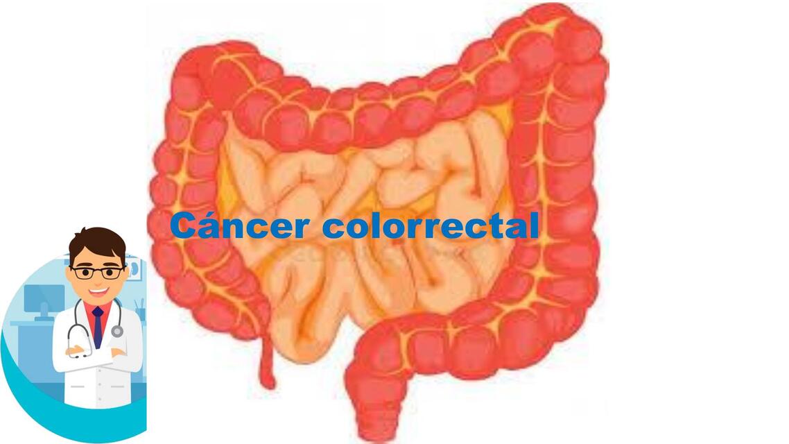 Cáncer colorrectal | uDocz