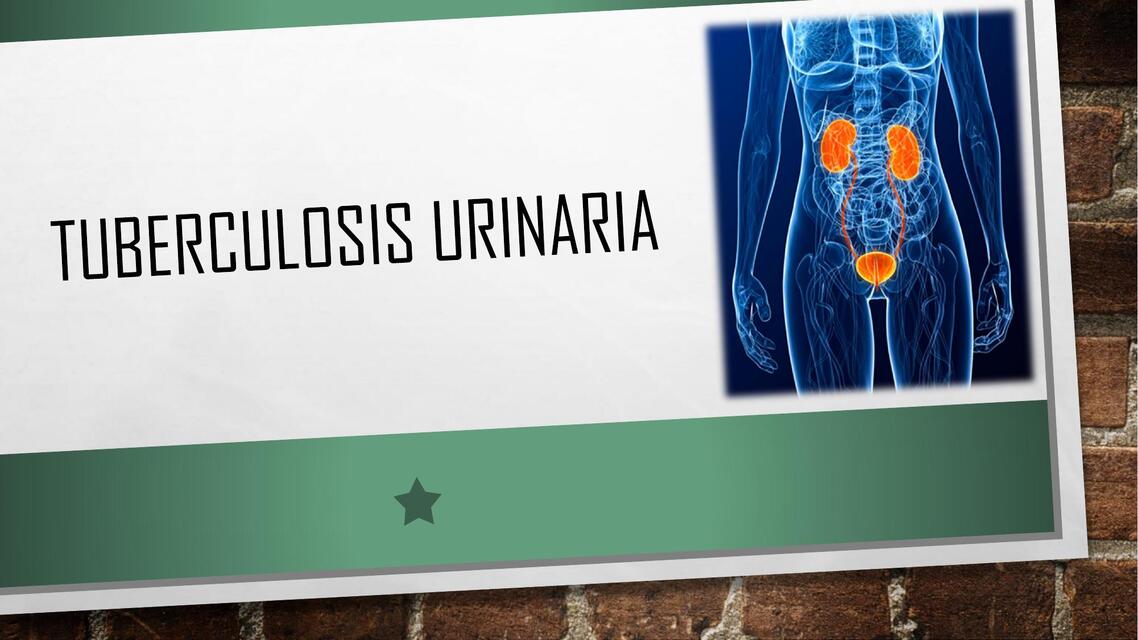 Tuberculosis urinaria | uDocz
