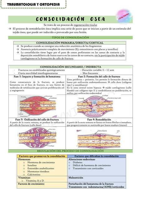 Consolidación ósea | StudyWithMed | uDocz