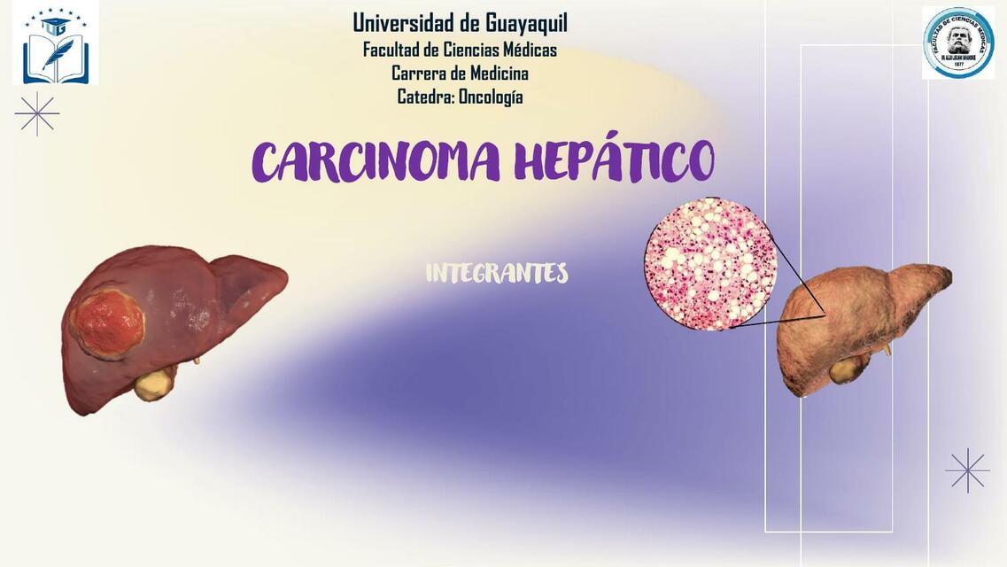 Carcinoma hepático | Angeles | uDocz