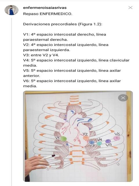 Derivaciones Del Ekg | Enfermero Isaias Rivas | uDocz